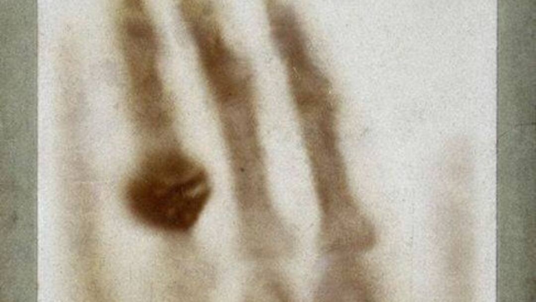 World Photography Day 2021: first ever X-ray image was taken in 1895 by ...