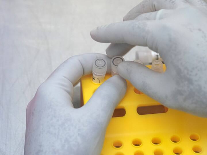 ICMR Develops Testing Kit To Detect Covid-19 With Omicron Variant In 2 ...