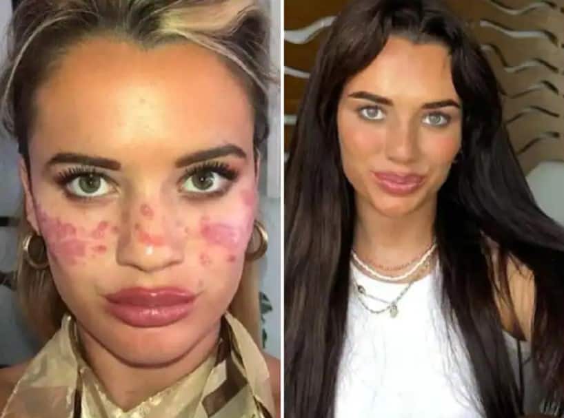 tattoo spoiled australian model Tilly Whitfeld face shared her video ...