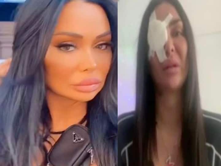 Australian TikTok star acid thrown in face while livestreaming video ...