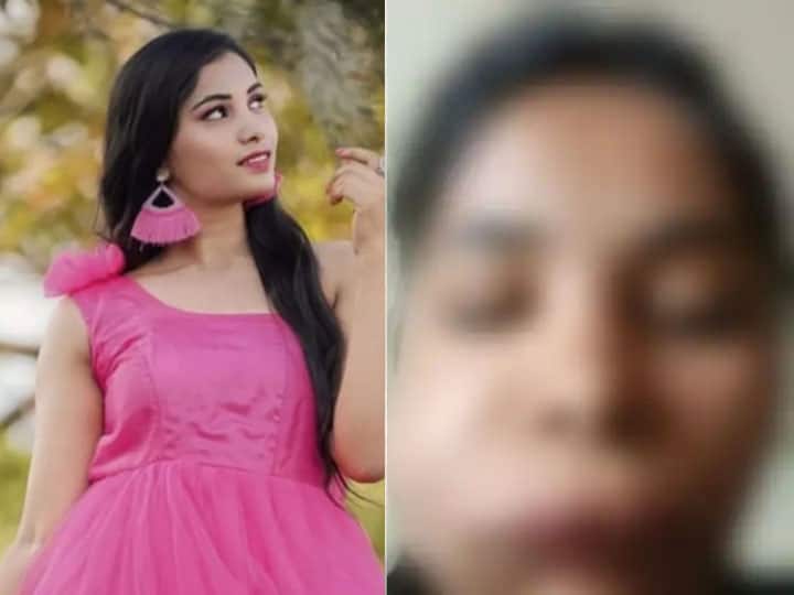 Swathi Satish alleges negligence after root canal surgery dentist ...