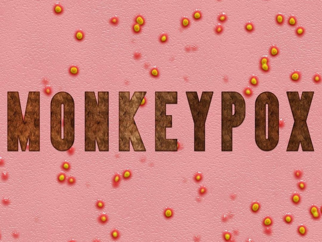 Monkeypox lifestyle marathi news Beware monkeypox virus outbreak in ...