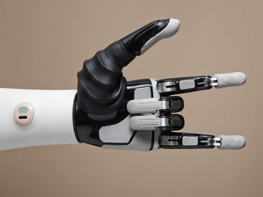 Motorica Artificial Intelligence Can Help Control Fingers Of Bionic ...