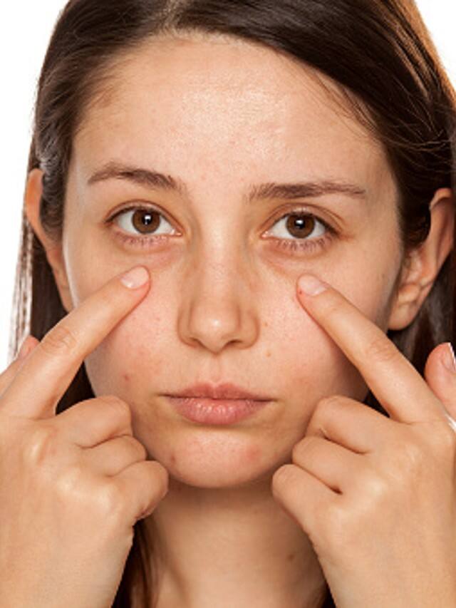 tips to get rid off dark circles all you need to know