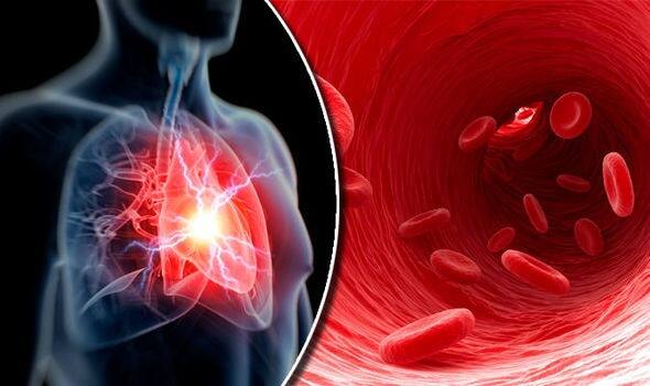 What Are The Types Of Heart Attack What Happens In Body When Heart ...