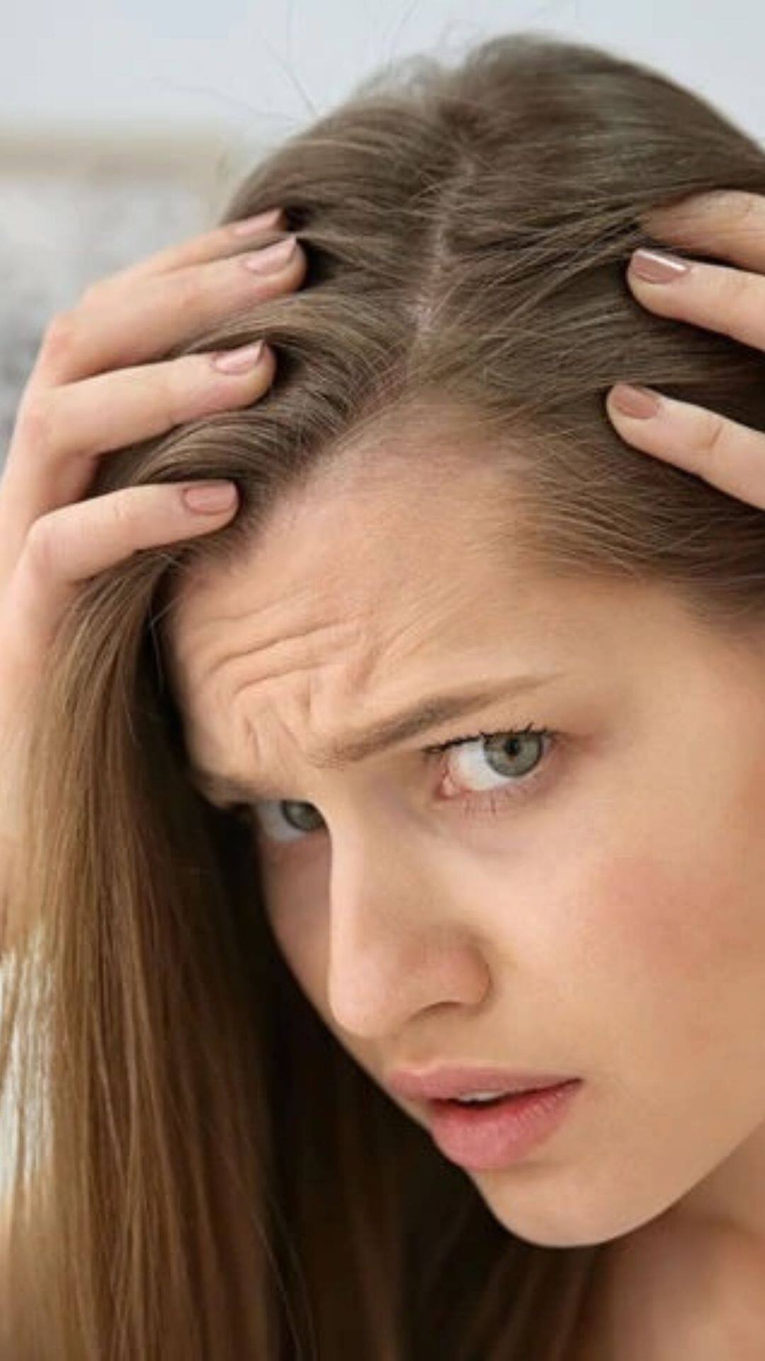 কন্ডিশনার ব্যবহারে কি চুল পড়ে?