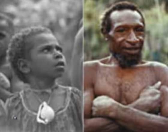 Fore Tribe Where People Used To Eat Human Brain At The Time Of Funeral ...