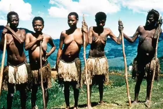 Fore Tribe Where People Used To Eat Human Brain At The Time Of Funeral ...