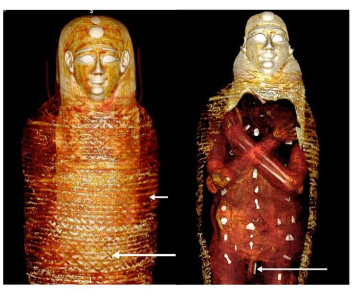 Golden boy mummy was protected by 49 precious amulets CT scans reveal ...