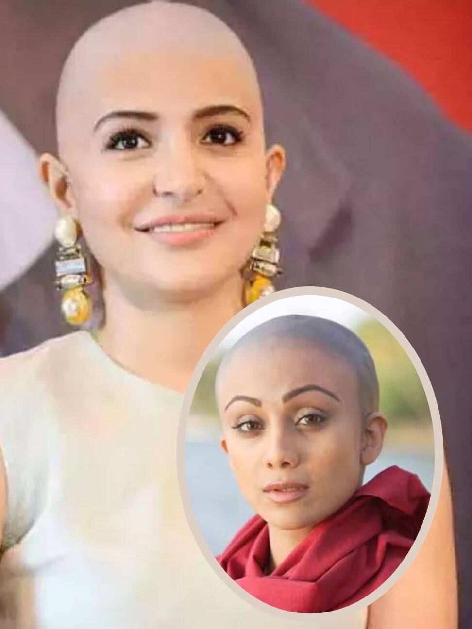 फिल्मों के रोल के लिए Bald हुई ये एक्ट्रेसेस