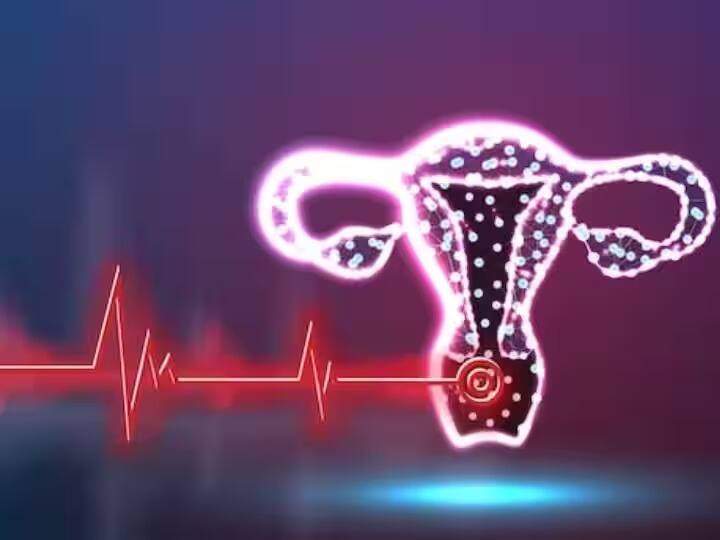 Health Tips study reveals 70 percent of indian women face pcos and ...