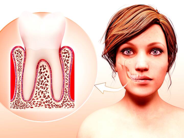 Sickle Cell Anaemia To Lysosomal Storage Disorders 10 Rare Diseases In ...