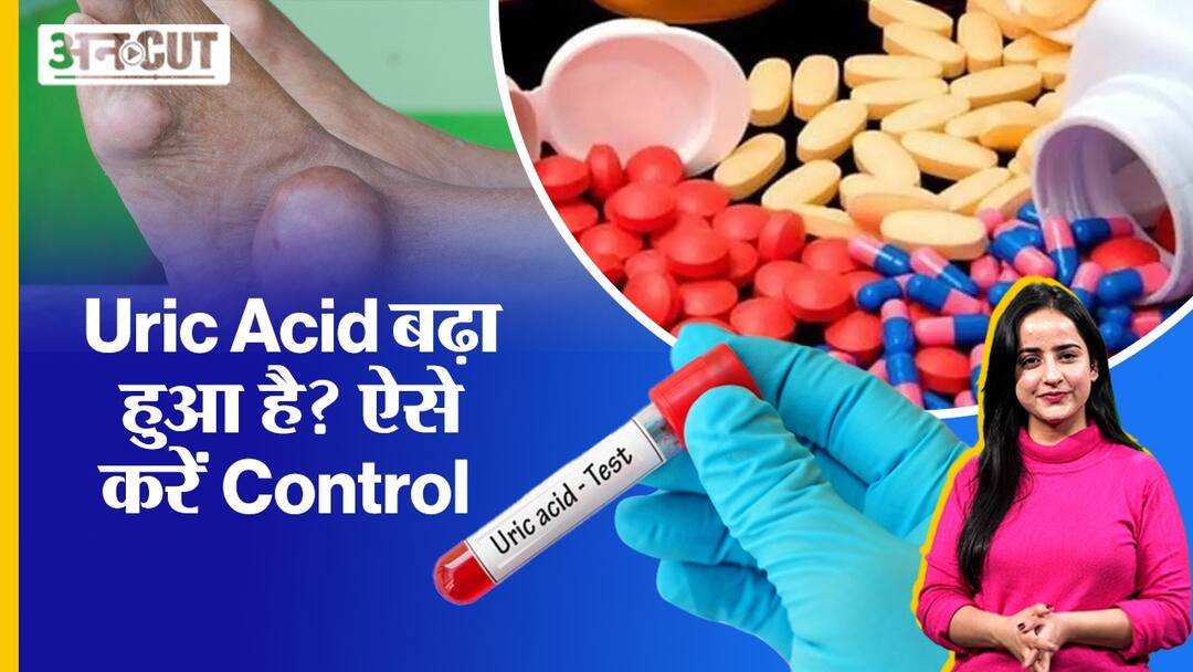 How to control Uric Acid: Uric Acid बढ़ा हुआ है ? ऐसे करें Control ...