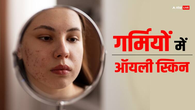 Want Treatment For Oily Skin Then Start Using These Home Remedies