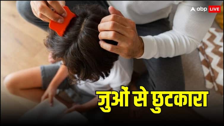 Facing Problem Of Lice In Your Head Then Do These 5 Home Remedies