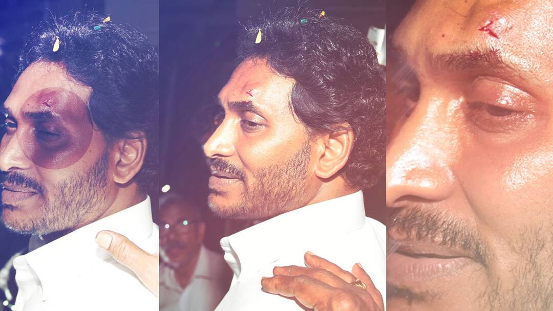 CM Jagan Stone Attack | CM Jagan Stone Attack | సీఎం జగన్ పై రాయి దాడి కేసులో పోలీసు దర్యాప్తు ...