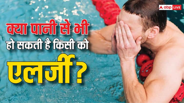 Water Allergy What Is Aquagenic Urticaria And Its Symptoms Water