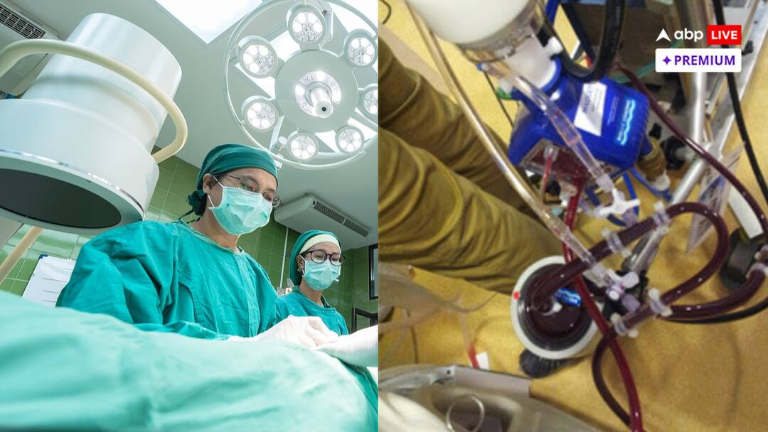 Health News ECMO Supports Critically ill lungs and heart know how it works abpp | Health News ...