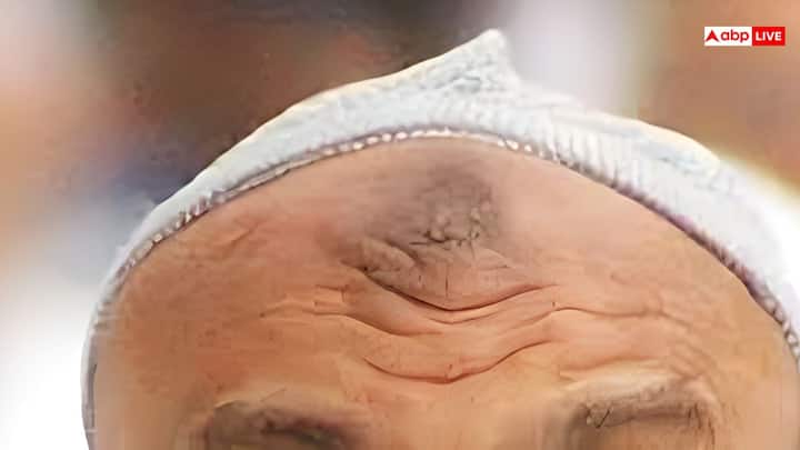 Muslims have a black mark on their forehead Why do what's relation with ...